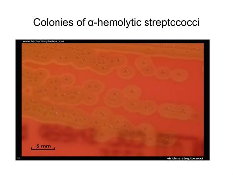 Staphylococcus Streptococcus Bacteriological Diagnosis Ii Ppt