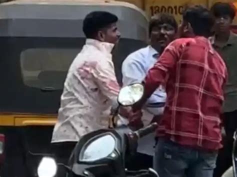 Pune 42 Year Old Man Attacked With Koyta On Fc Road In Broad Daylight