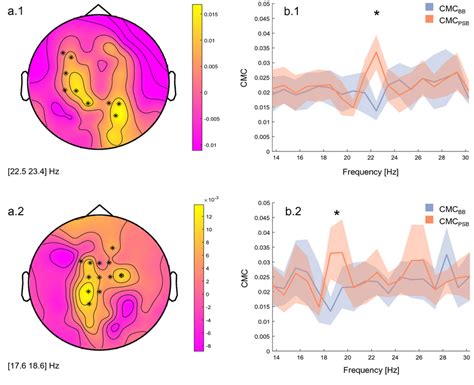Corticomuscular Coherence Topographic Maps And Spectra On The