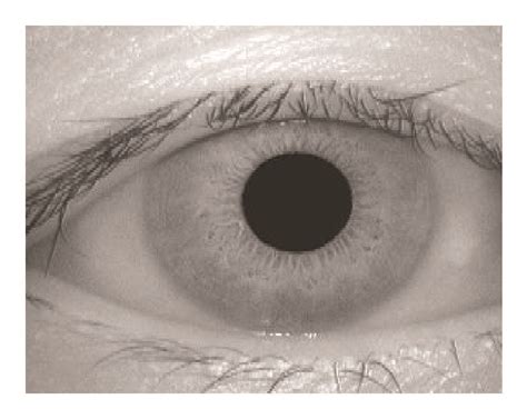 A The Original Image B Segmentation C Normalization D Download Scientific Diagram