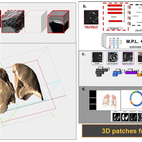 the artificial intelligence framework to diagnose pulmonary