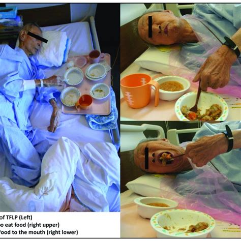 The Process Of Temporal Flat Lateral Position TFLP Temporal Flat Download Scientific Diagram