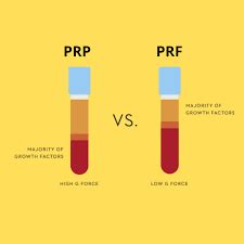 What Are The Differences Between PRP And PRF Rejuvenate Face