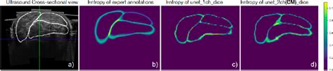 Figure 1 From Can Ultrasound Confidence Maps Predict Sonographers Labeling Variability