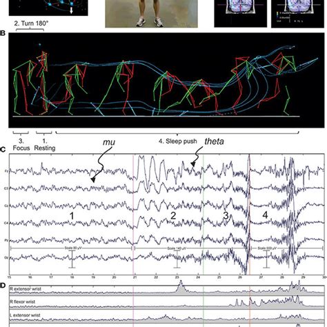 a recording configuration simultaneous eeg lfp and whole cell