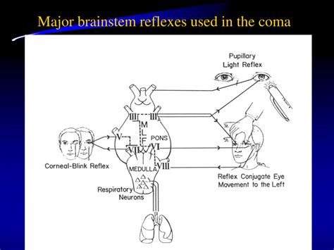 Ppt Coma And Brain Death （昏迷與腦死） Powerpoint Presentation Id945586