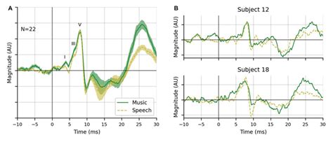 General Music And Speech Evoked Abr Waveforms Using The Anm As The Download Scientific Diagram