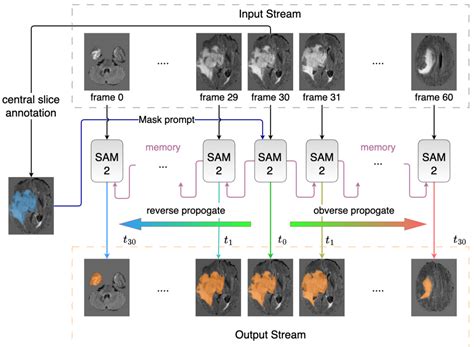 논문 리뷰 Interactive 3d Medical Image Segmentation With Sam 2