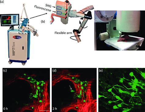 5 A Mptflex With Articulated Flexible Arm For Non Invasive