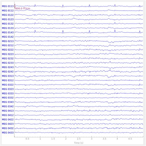 overview of meg eeg analysis with mne python — mne 1 11 0 dev12