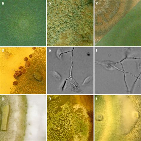 Characteristic Features Of Trichoderma Spp A T Reesei And B T Download Scientific Diagram