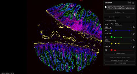 Hands On End To End Tissue Microarray Image Analysis With Galaxy Me End To End Tissue