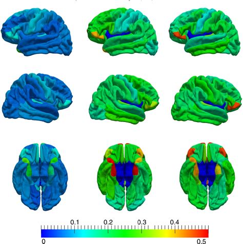 Figure 1 From A Comparison Of Voxel And Surface Based Cortical Thickness Estimation Methods