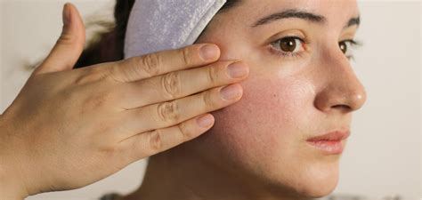 Understanding Rosacea Triggers A Guide To Minimising Flare Ups Happiest Health