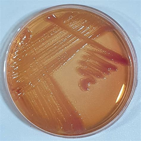 🔹️enterobacter Cloacae Complex On علم التحليلات المرضية