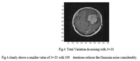 Analysis On Methods For Detecting Brain Tumor From MRI Images