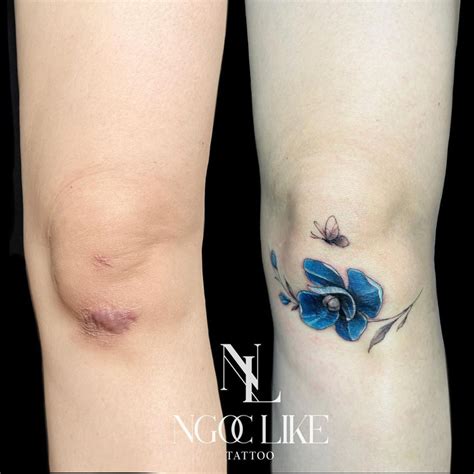 Knee Scar Tattoo Healing Art With Symbolic Meaning