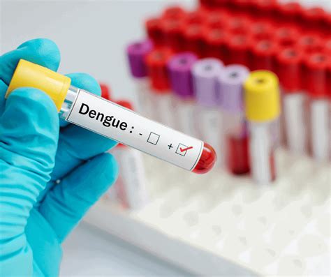 Pangasinan Records 424 Dengue Cases