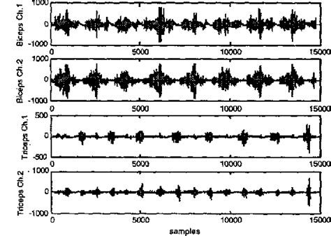 figure 1 from myoelectric signal segmentation and classification using