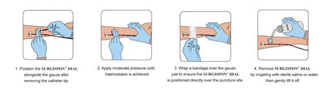 The Future Of Dialysis Care Hemostatic Dialysis Bandage