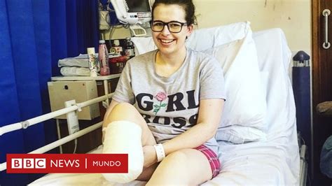 Por Qué Decidí Que Me Amputaran Una Pierna Bbc News Mundo