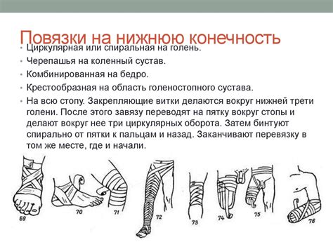 Десмургия. Виды повязок - презентация онлайн