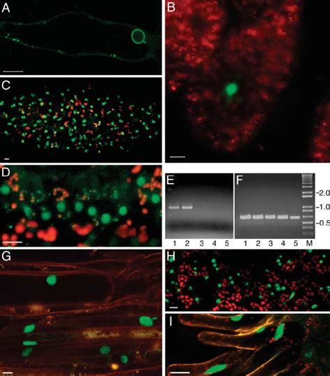 Proplastid Nuclear Membrane And Intranuclear Targeting A Yfp Maf1