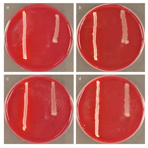 Differential Growth Stimulation Of Bacteroidetes Bacterium Hot 365 In