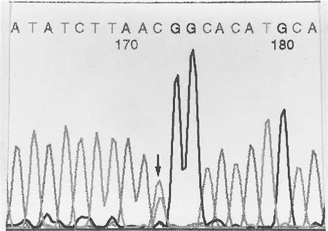 Figure 1 From An Mtdna Mutation In The Initiation Codon Of The Cytochrome C Oxidase Subunit Ii