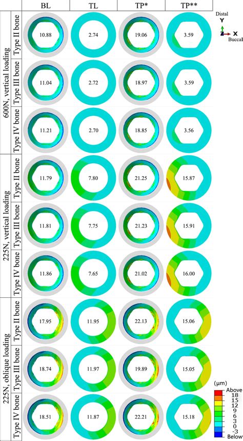 The Distribution Of The Interface Microgap In The Models With Different Download Scientific