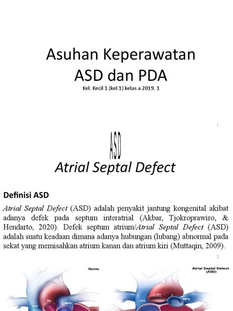 Askep Asd Dan Pda Kel 1 A 2019 1 Rev Pdf