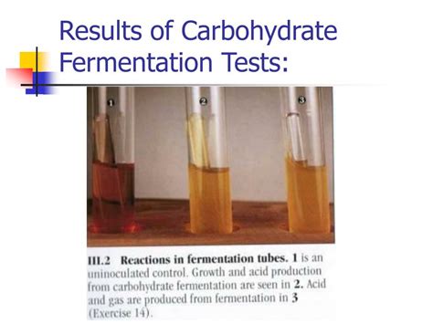 Ppt Biochemical Tests Powerpoint Presentation Free Download Id6696885