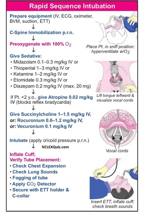 Rapid Sequence Intubation Algorithm Nclex Quiz