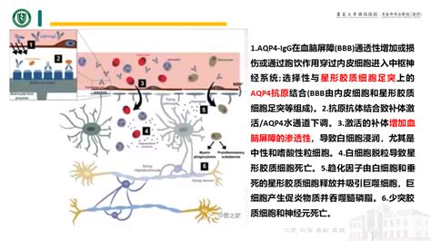 中国视神经脊髓炎谱系疾病诊断与治疗指南2021版）【幻灯版】 脑医汇 神外资讯 神介资讯
