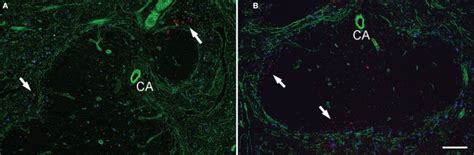 Infectious Foci Are Formed In Close Vicinity Of Marginal Zone Area