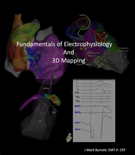 Fundamentals Of Electrophysiology And D Mapping EBook By J Mark Burnett EPUB Rakuten Kobo