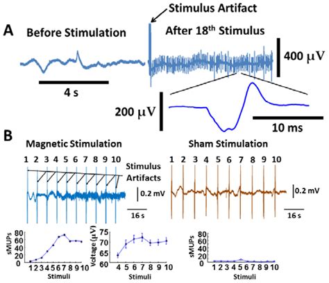 Spontaneous Motor Unit Potentials In Response To Repeated Stimulation Download Scientific