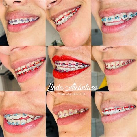 Dentista Linda Alcántara Tijuana