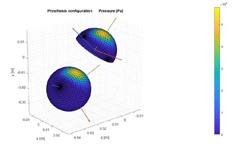 prosthesis configuration due the chosen relative rotations download
