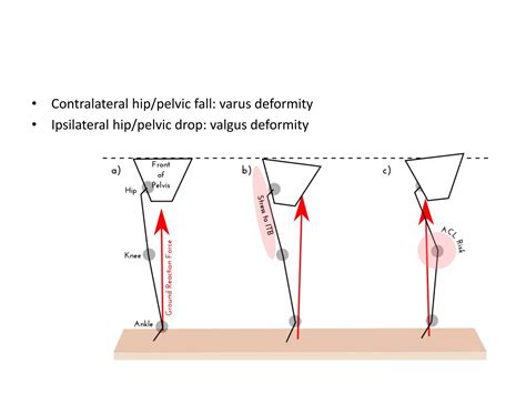 Pelvic Hip Knee Bones Joints And Muscles Pptx