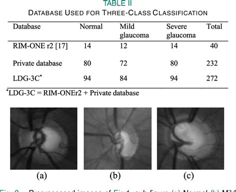 table vi from automated classification of glaucoma stages using
