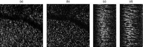 Figure 2 From Correction Of Aberrations In The Human Eye Using