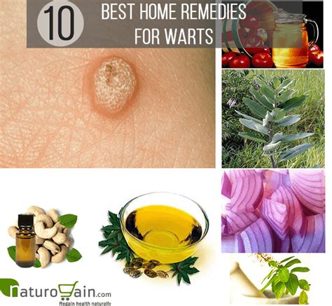 Best Genital Warts Treatment How To Treat Genital Warts Lswe