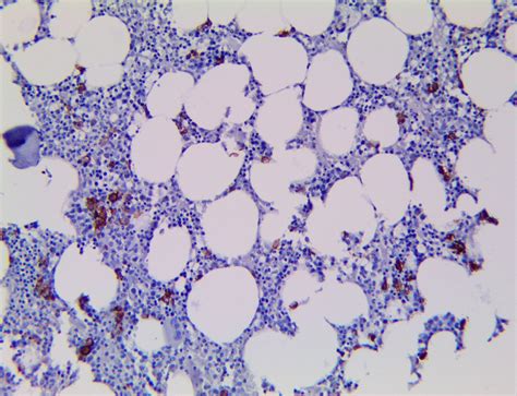 Cd138 Antibody Rbt Cd138 Bio Sb