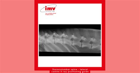 Free Download Thoracolumbar Spine Lateral X Ray Positioning Guide