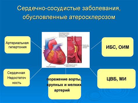 Болезни сердца заболевания