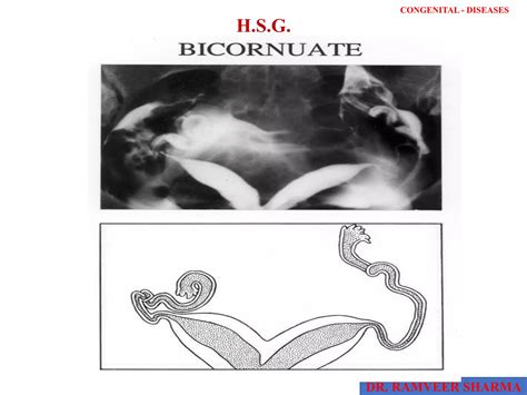 2 2 Congenital Deformities Pdf