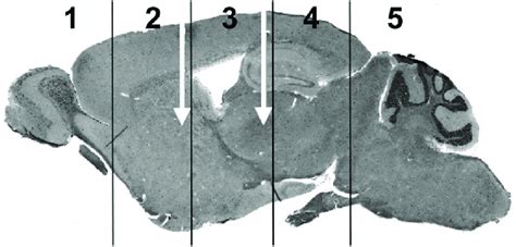 Intraparenchymal Injection Of Lys Saf302 In Mps Iiia Mice The Injection Download Scientific