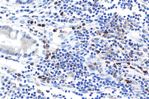 Ihceasy Tnfr2 Tnfrsf1b Ready To Use Ihc Kit Khc1156 Proteintech
