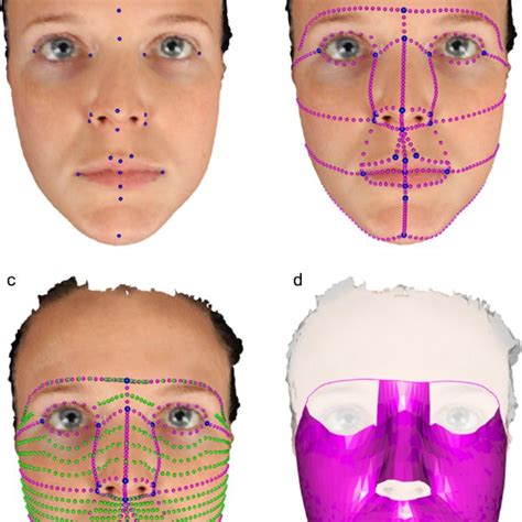 Pdf Assessing The Outcome Of Orthognathic Surgery By Three Dimensional Soft Tissue Analysis